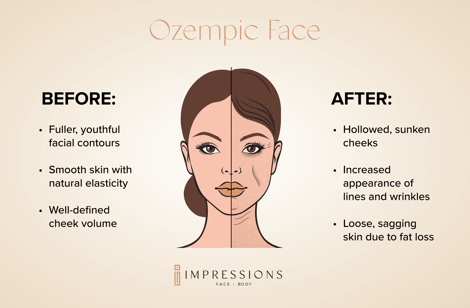 How to Fix Ozempic Face | Impressions Face + Body | Chicago