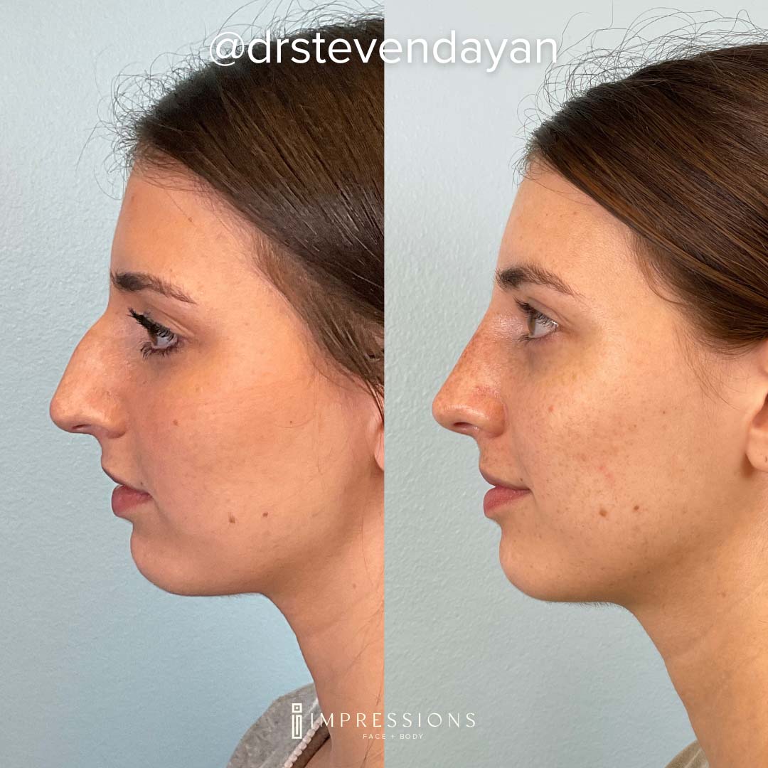 Surgical Transformations