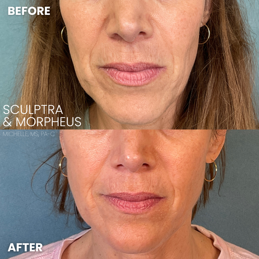 Surgical Transformations