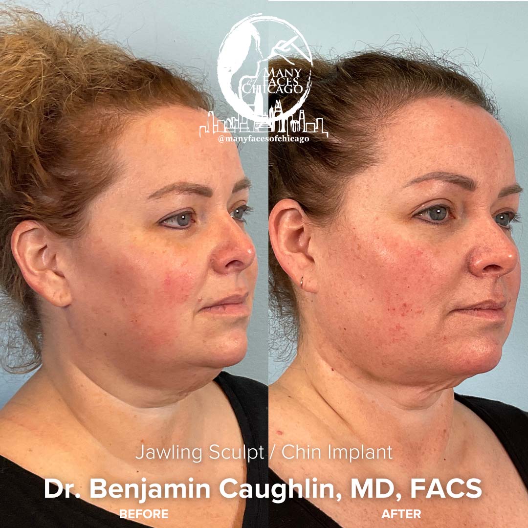 Surgical Transformations