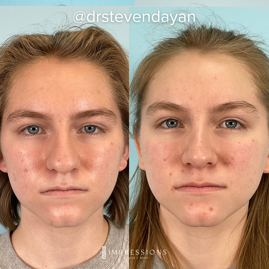 Surgical Transformations