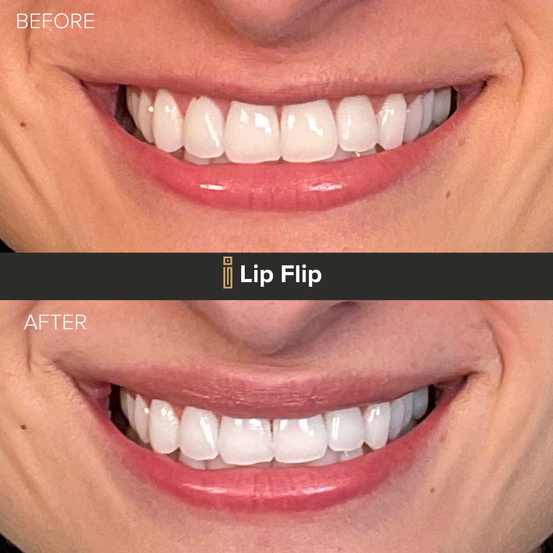 Surgical Transformations