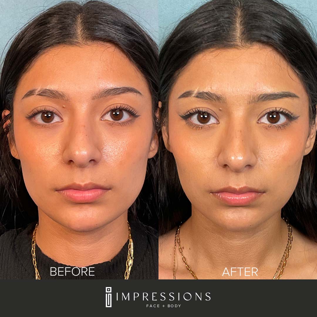 Surgical Transformations