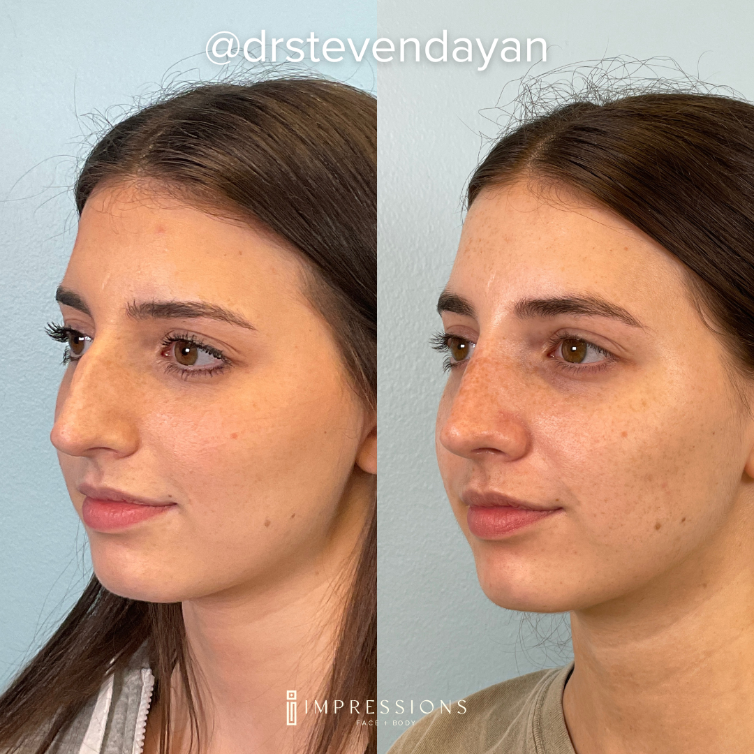 Surgical Transformations