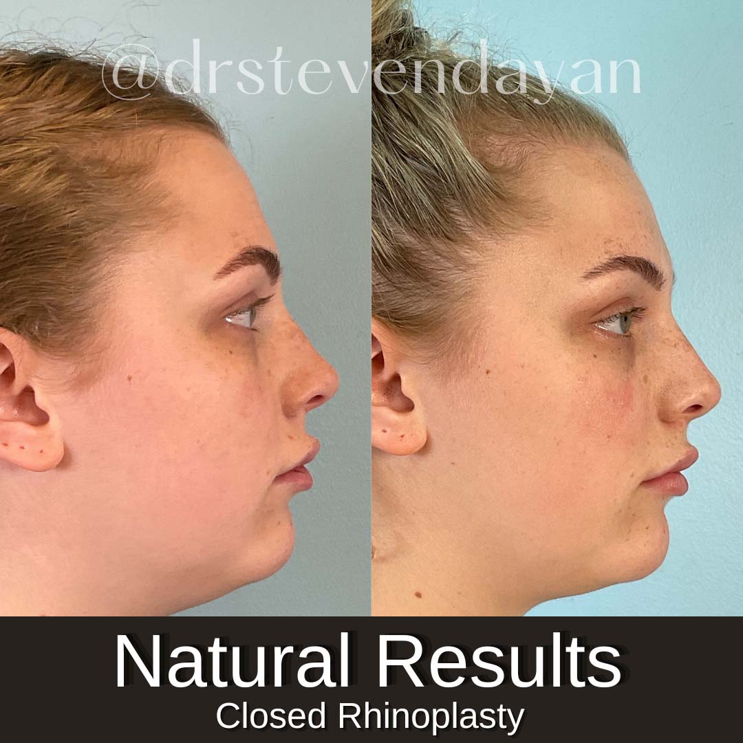 Surgical Transformations